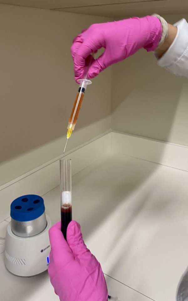 PRP Vs. PRF: What's The Difference?